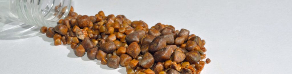 Gallstones - Medical Terminology Blog